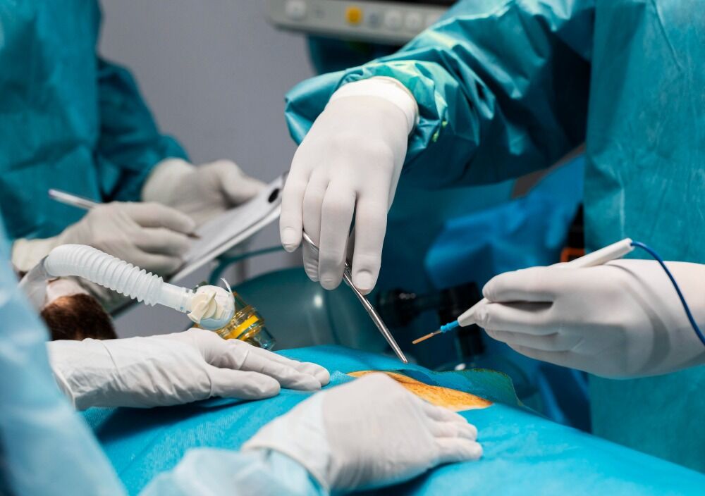 Laparoscopic Hernia Repair – MedWise Hospitals